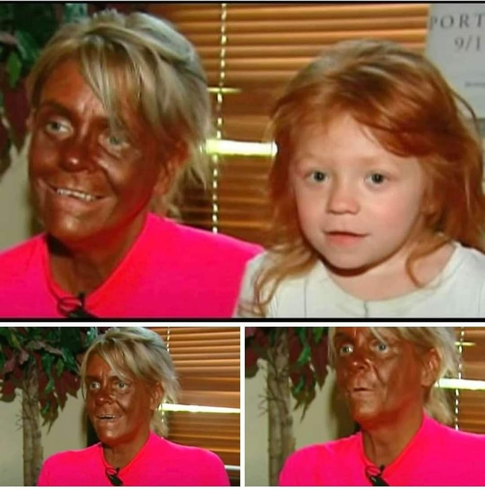What happened to ‘Tan Mom’ Patricia Krentcil? This is what she looks ...