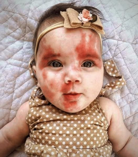 Wait Until You See This Gorgeous Child Now! This Baby With A Red ...