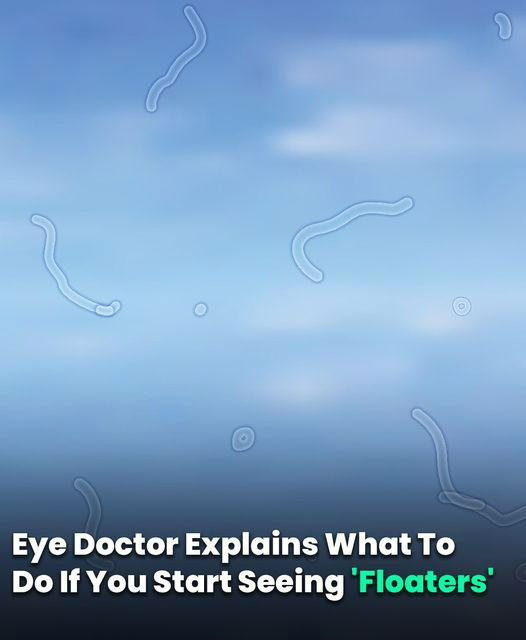 What Are Eye Floaters? Here What To Do If you Start Seeing Them ...