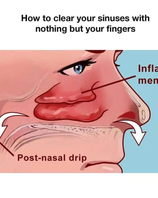 Instant Sinus Relief: How Your Fingers Can Help Clear Congestion ...