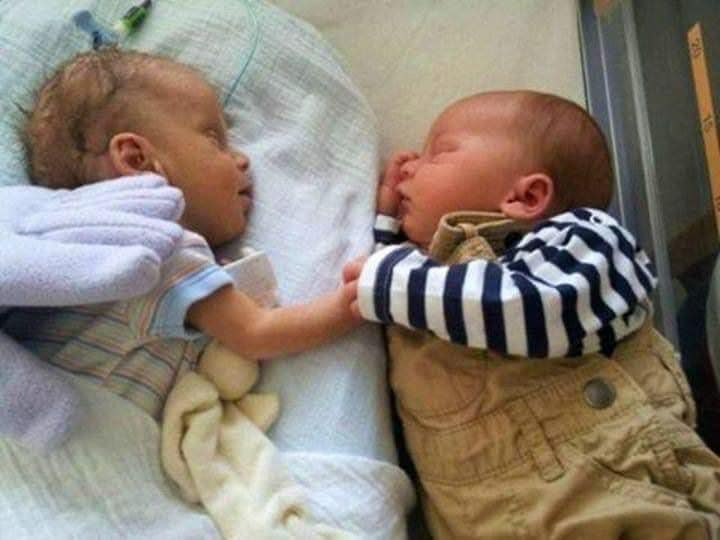 Nurse Puts Dying Baby Next To Her Twin. She Gives Her A ‘Hug’ That ...
