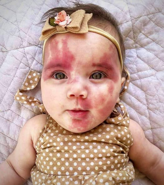 Baby called ‘hideous’ is a gorgeous little girl now - Weveryday Stories