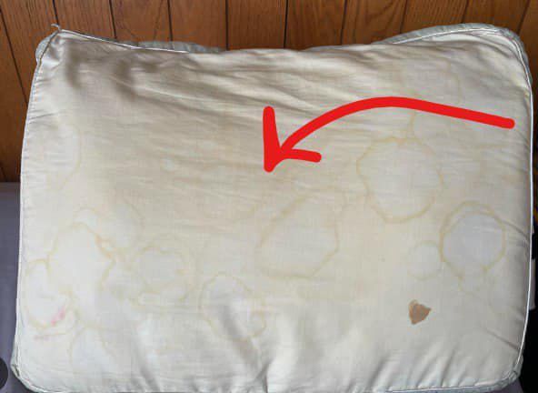 The Causes of Yellow Stains Explained - Weveryday Stories