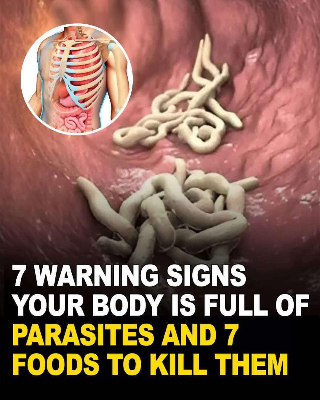7 signs that you may have intestinal parasites in your body - Weveryday ...
