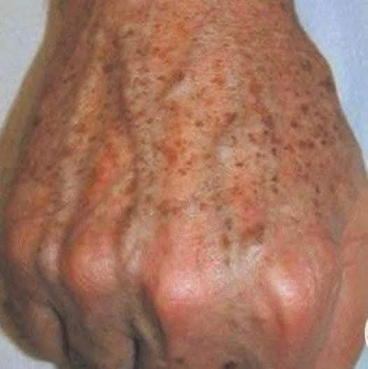 Did you know that if you get STAINS on your HANDS it’s because you have ...
