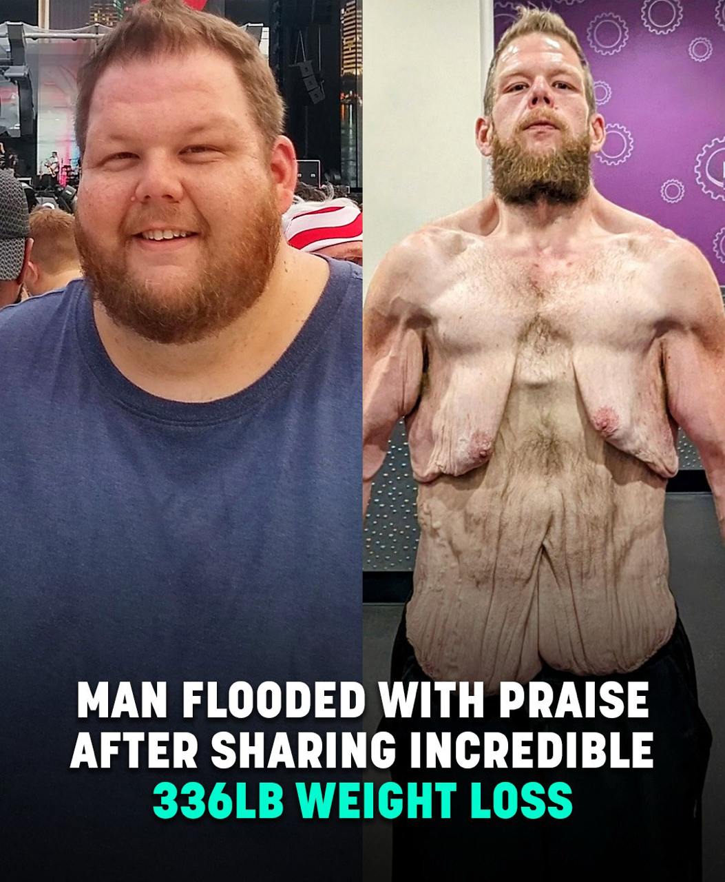 Man loses over 360 pounds by walking every day – ‘I saved myself ...