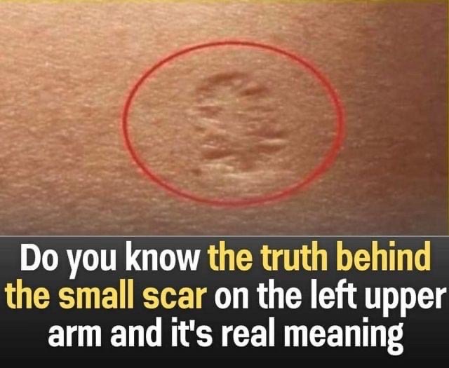 Discover the meaning behind the “scar on your arm.” - Weveryday Stories