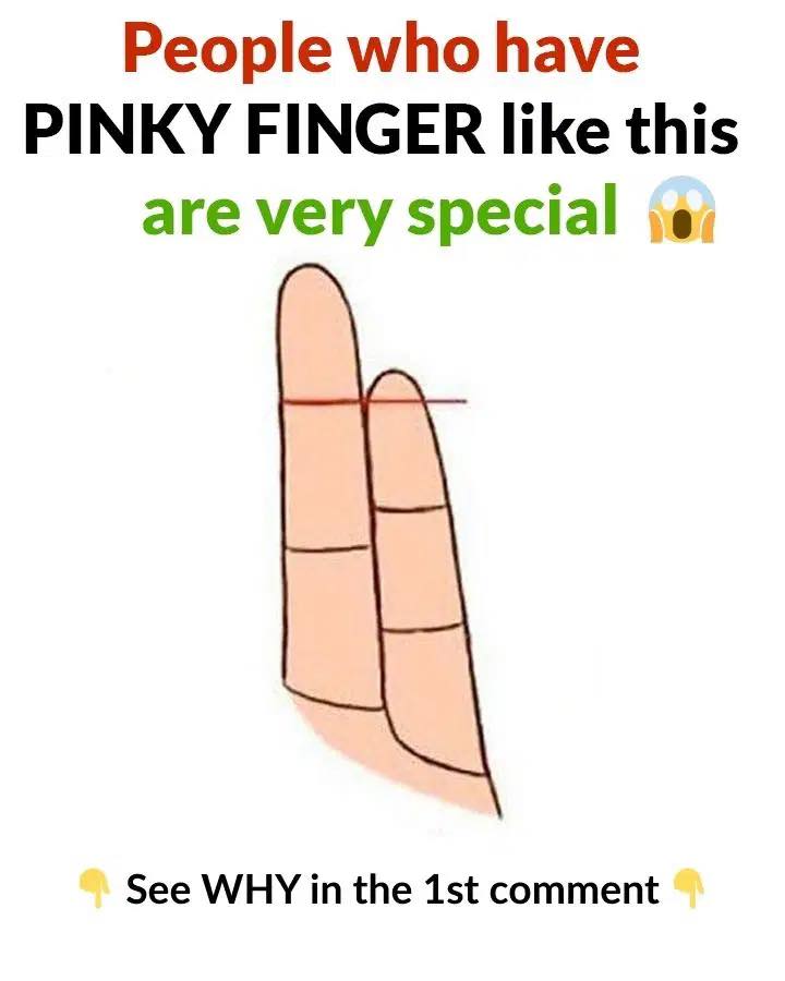 People who have PINKY FINGER like this are very special - Weveryday Stories