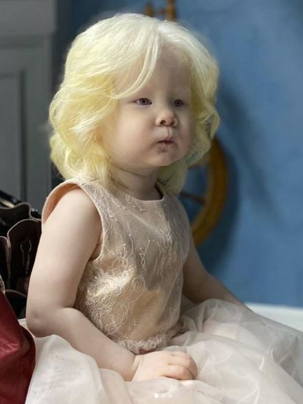 Albino sisters born 12 years apart become modeling sensations ...