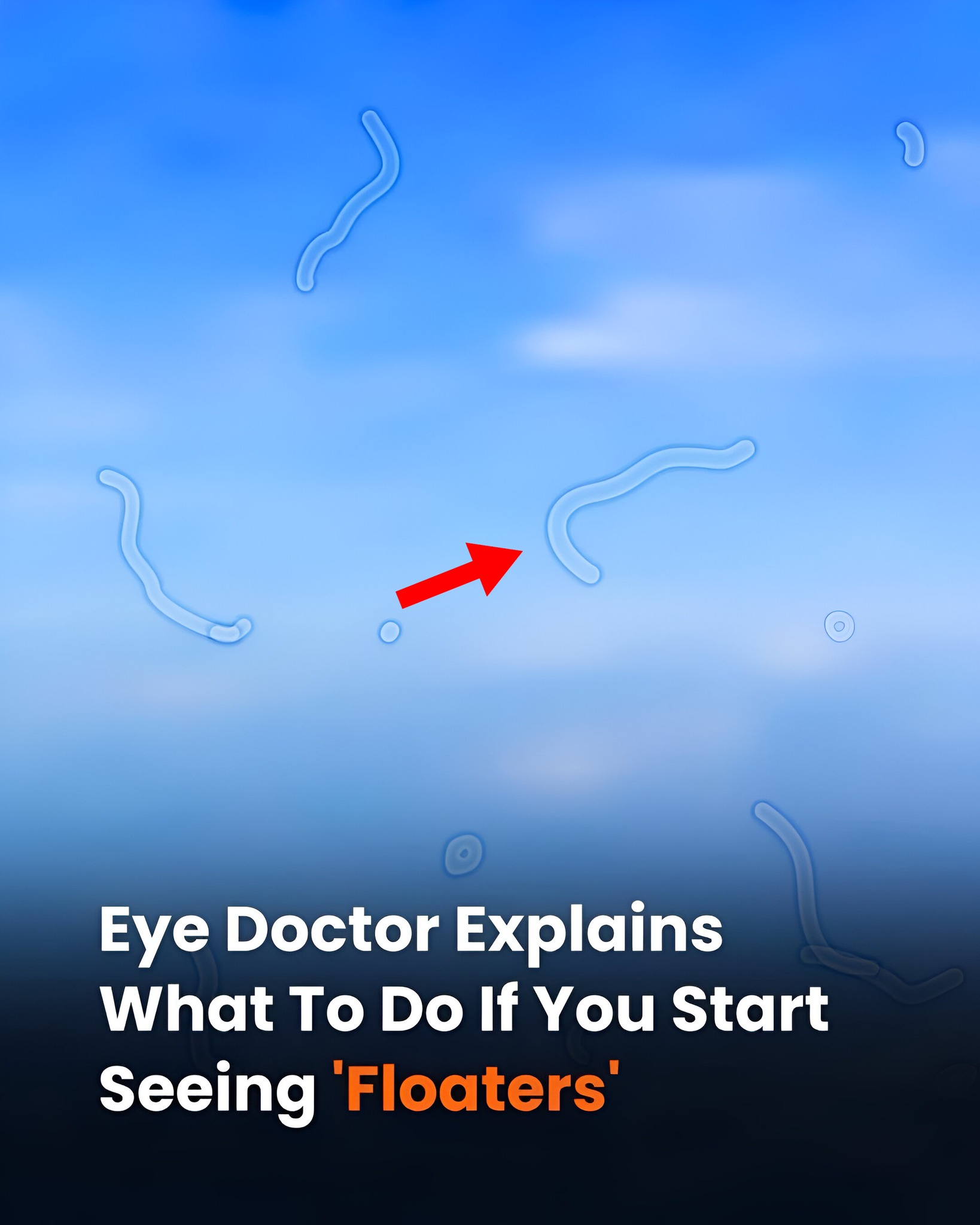 What Are Eye Floaters? Here What To Do If you Start Seeing Them - Weveryday Stories