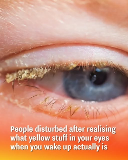 People Stunned After Learning What the Yellow Substance in Your Eyes ...