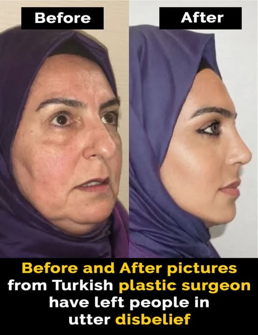 People can’t believe the results of the surgeon’s cosmetic work ...