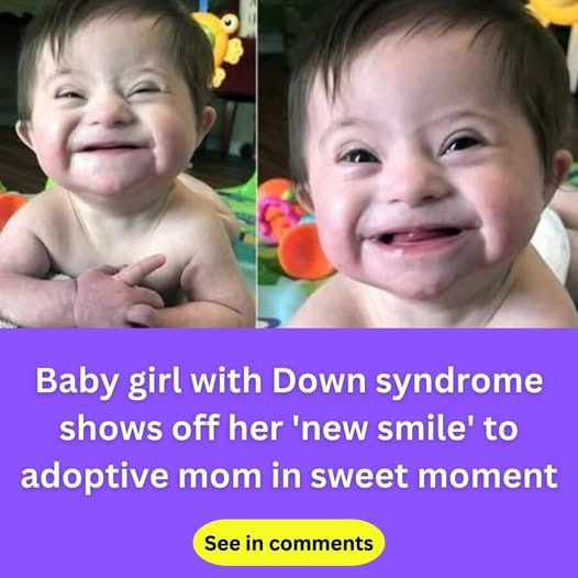 Adopted baby with Down syndrome goes viral after smiling for mom ...