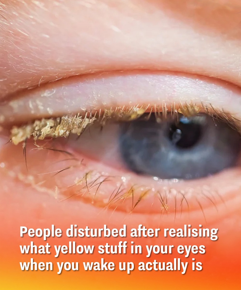 The yellow stuff in your eyes when you wake up? People are grossed out ...
