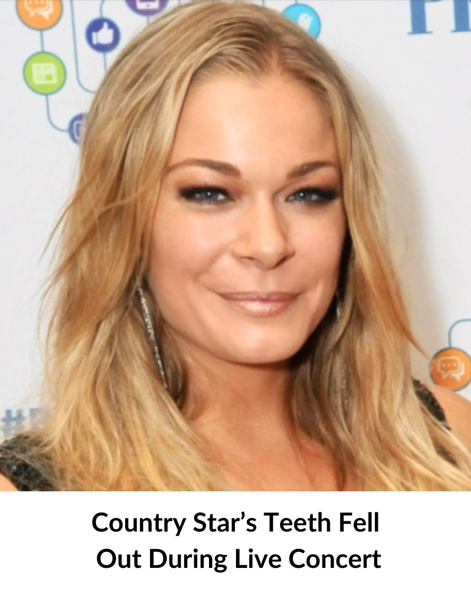 Country Star’s Teeth Fell Out During A Live Performance - Weveryday Stories
