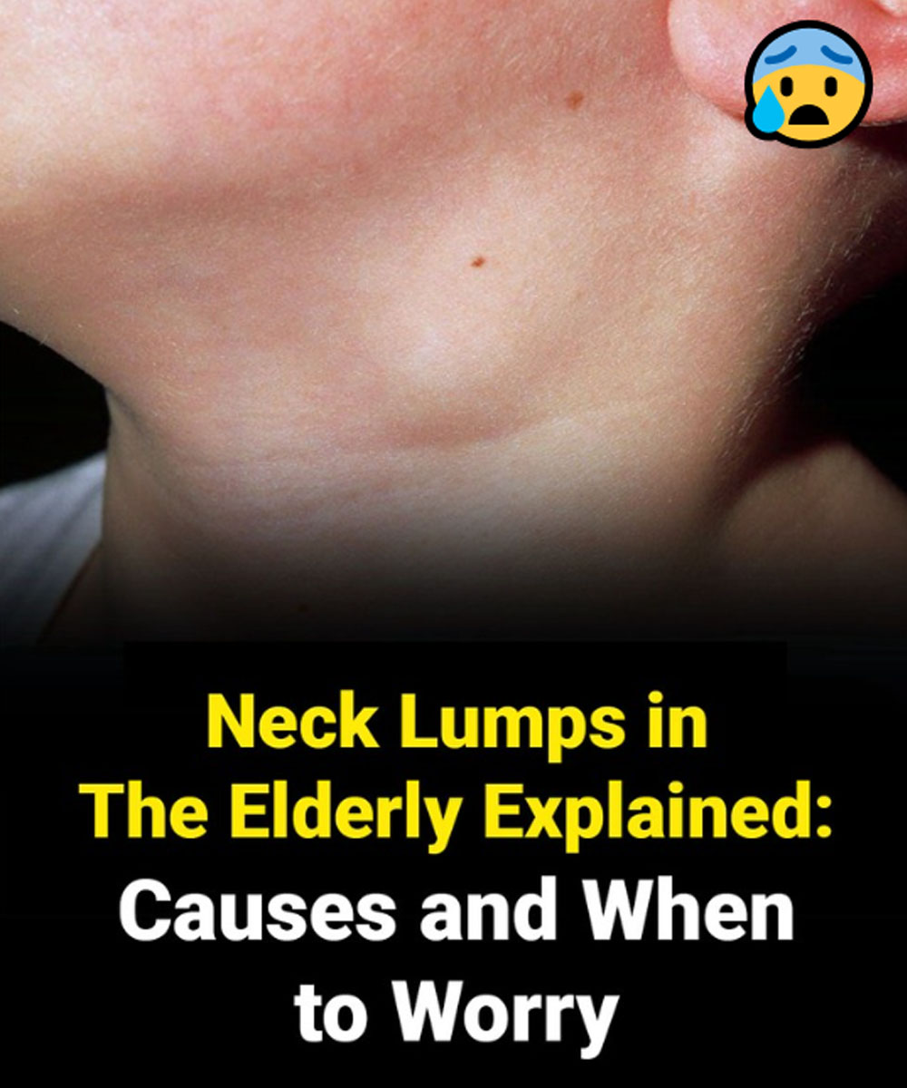 What do Neck Lumps in the elderly Mean - Weveryday Stories