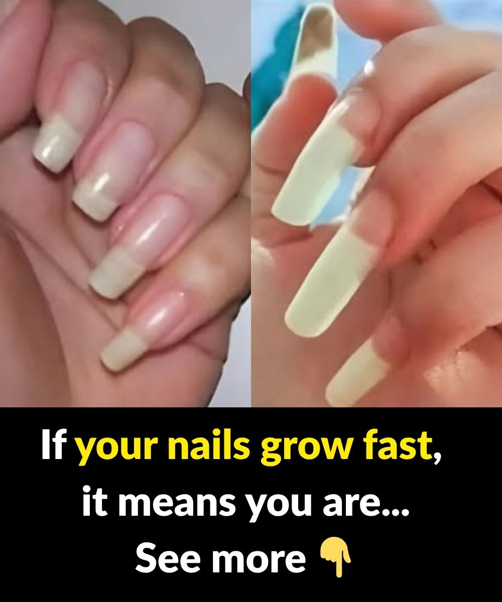 What It Really Means If Your Fingernails Grow Fast - Weveryday Stories