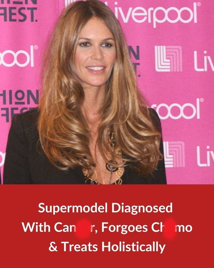 Supermodel Diagnosed With Can.*er And Decided Not To Do Che.mo.therapy ...