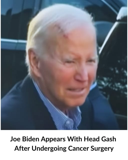 Joe Biden Appears With Head Bandage After Undergoing Cancer Surgery ...