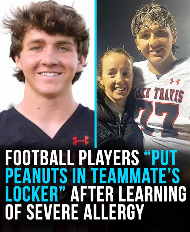 Football players “deliberately put peanuts in severely allergic ...