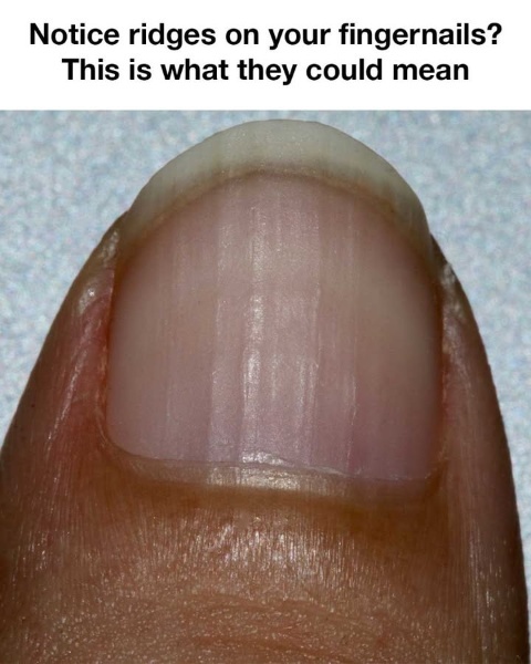 What Ridges on Your Fingernails Can Say About Your Health - Weveryday ...