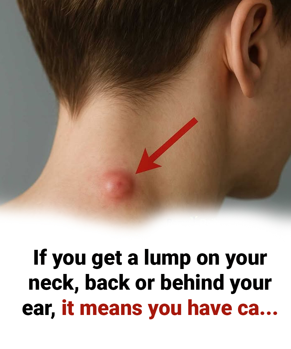 Noticed a lump on your neck, back, or behind your ear? Here’s what you ...