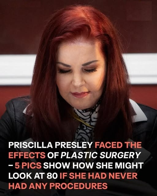 How Priscilla Presley Could Have Looked Today If She Avoided a Bad ...