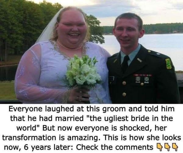 She earned the harsh title of “the ugliest bride in the world ...